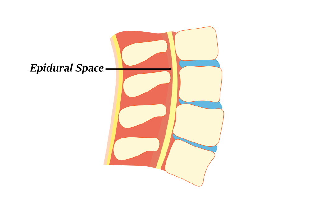 Epidural Space Diagram
